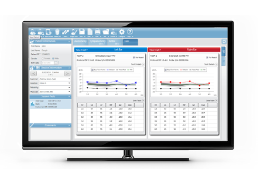 Grason-Stadler - France