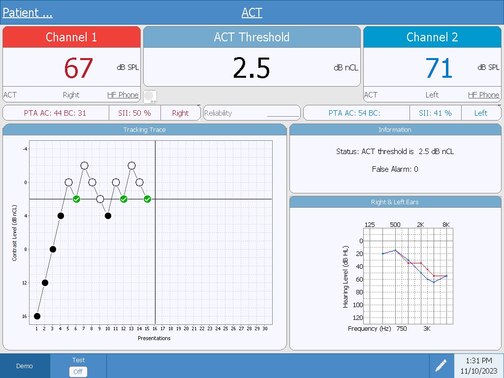Audible Contrast Threshold Test | Grason-Stadler